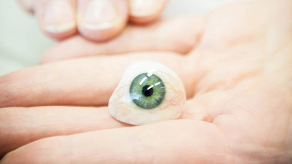Una persona recibe la primera prótesis de ojo con tecnología 3D